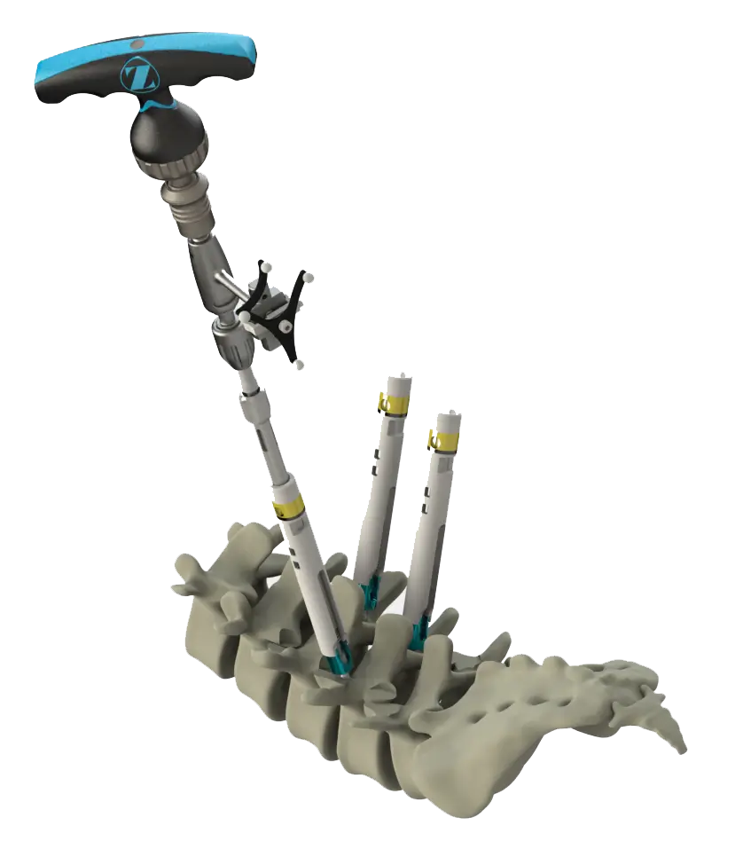 Universal Navigation System - HIGHRIDGE MEDICAL